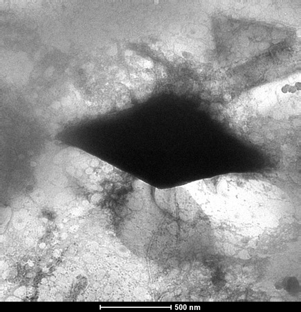 CIL:41751, Bacillus thuringiensis | Library Digital Collections | UC ...